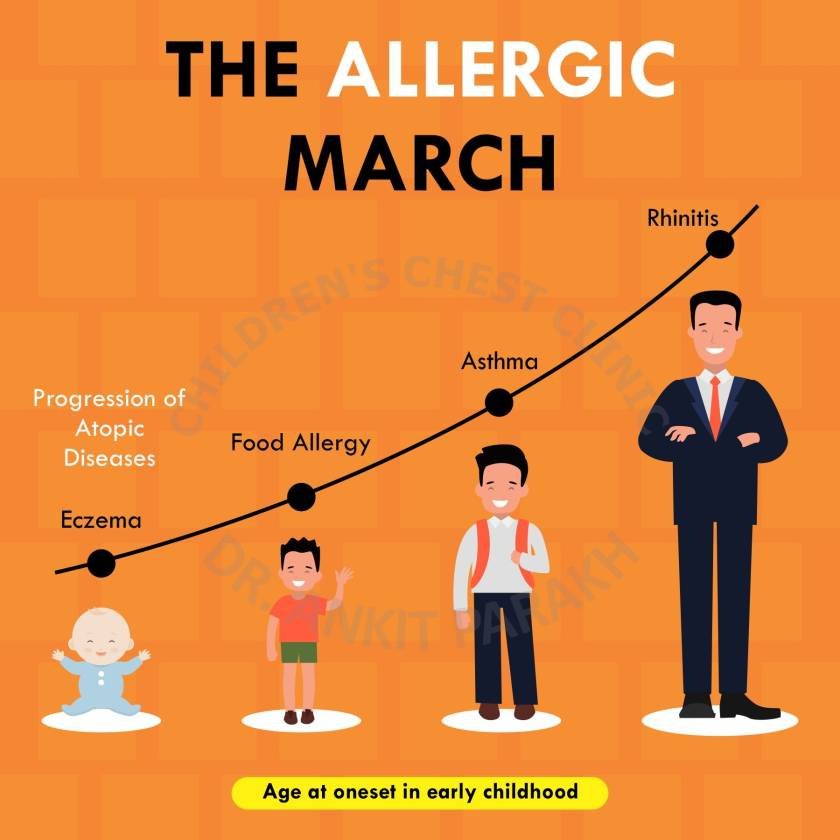 What Is the Allergic March? - Dr. Ankit Parakh – India's best Pediatric ...
