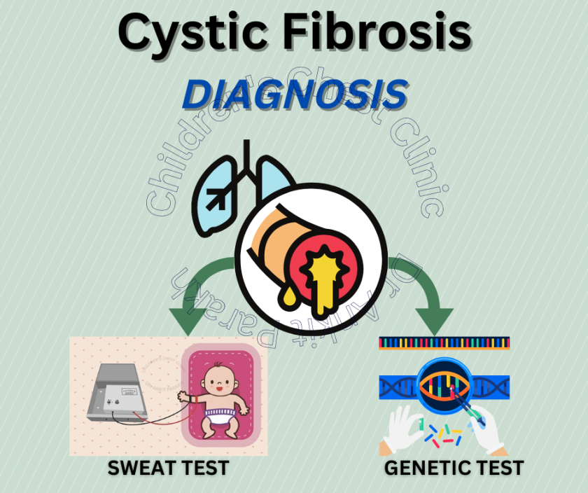 Cystic Fibrosis in Children: How do we diagnose? - Dr. Ankit Parakh ...