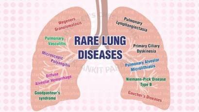 Rare Lung Disease – Dr. Ankit Parakh – India's best Pediatric ...