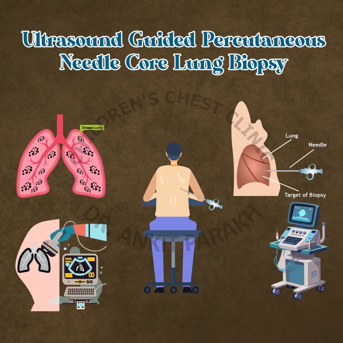 Ultrasound Guided Chest Procedures – Dr. Ankit Parakh – India's best ...